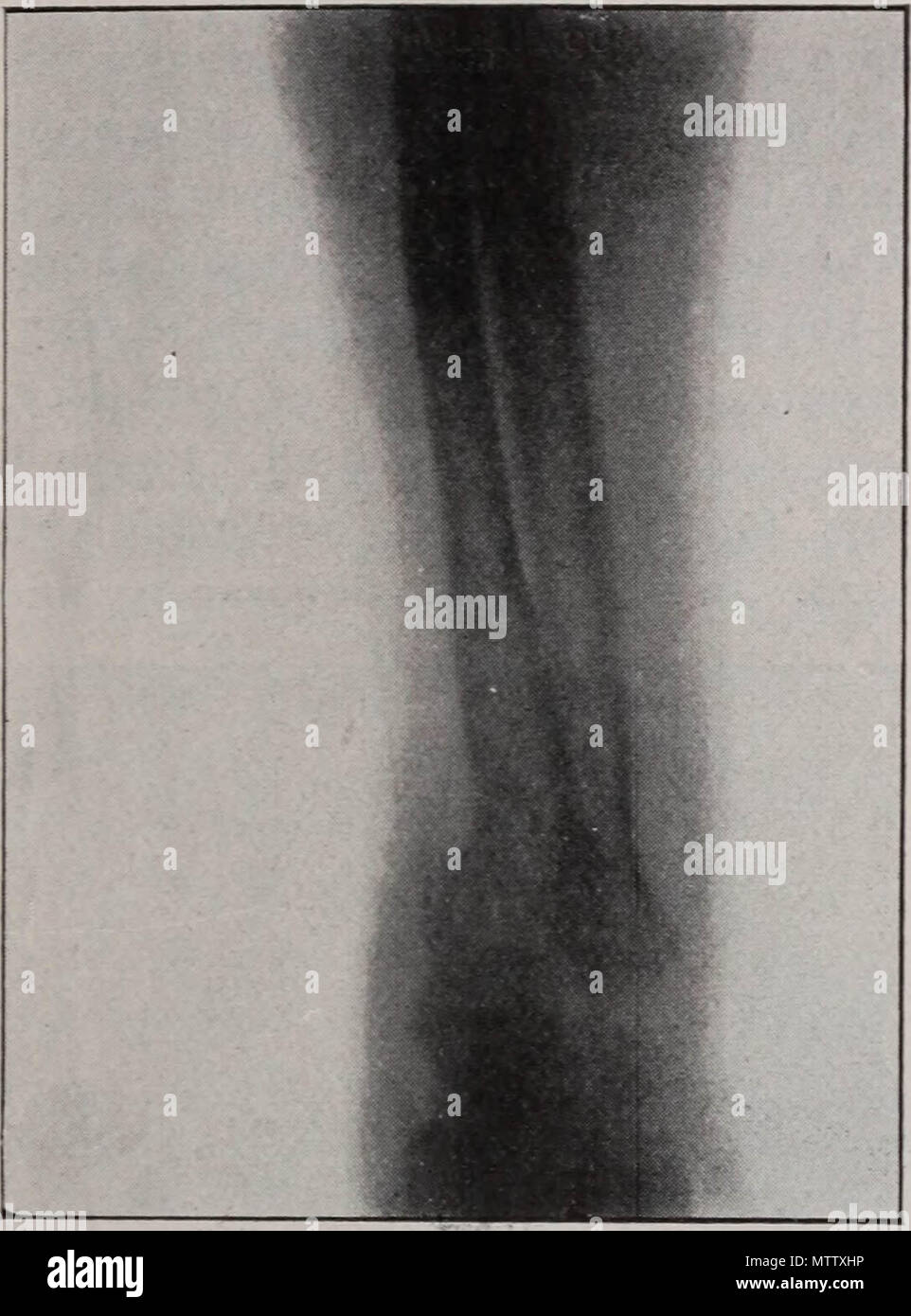 "American X-ray journal" (1900 Stock Photo - Alamy