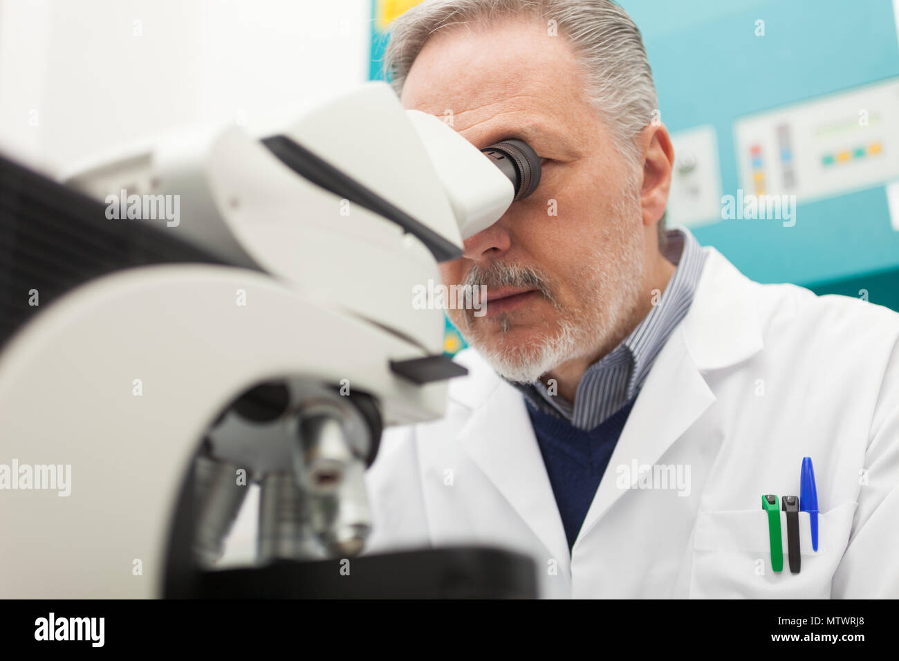 Hiv aids microscope hi-res stock photography and images - Alamy