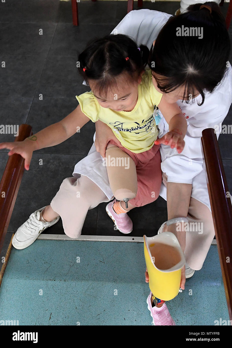 Prosthetic limb girls hi-res stock photography and images - Alamy
