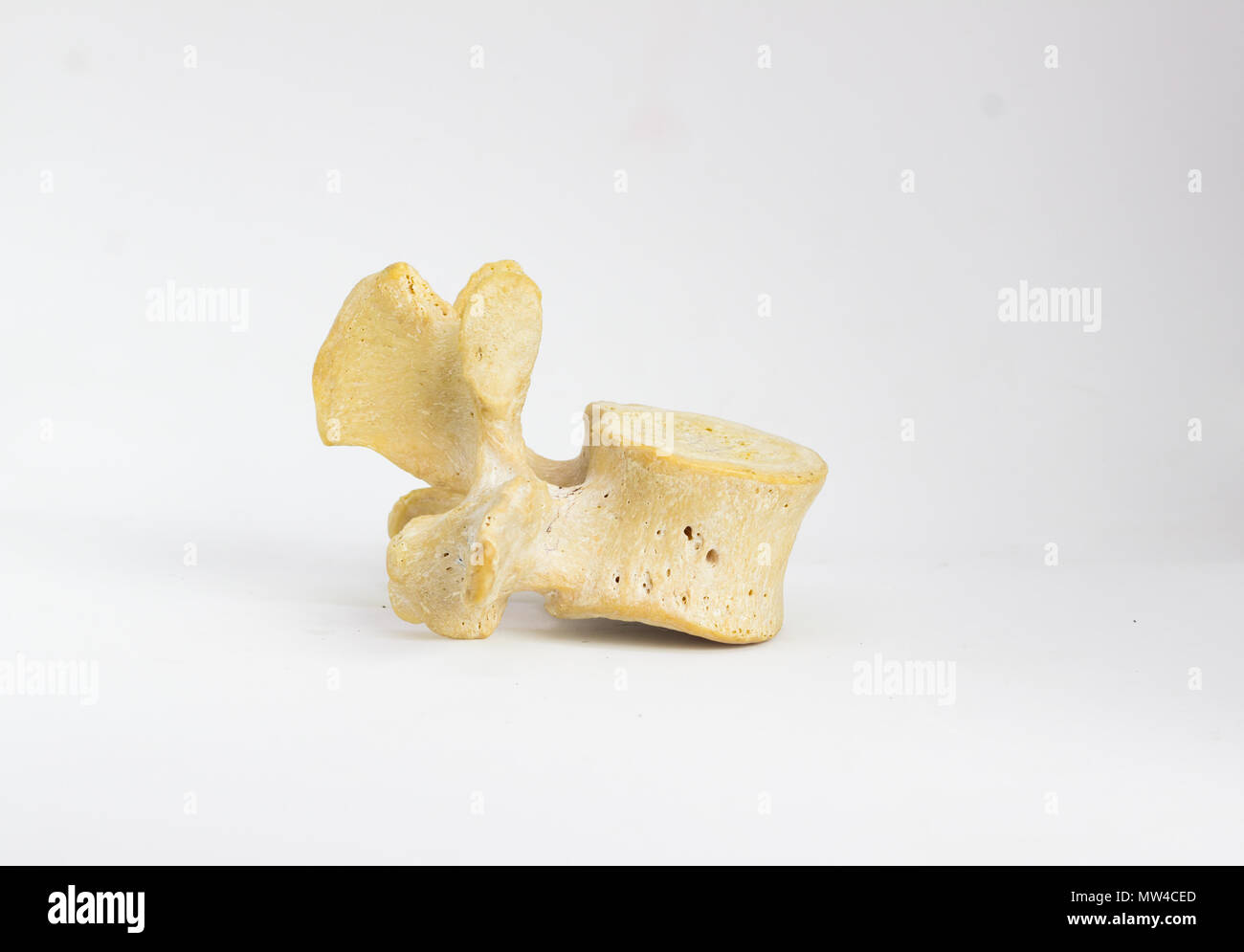side view of isolated human lumbar vertebra in white background with ...