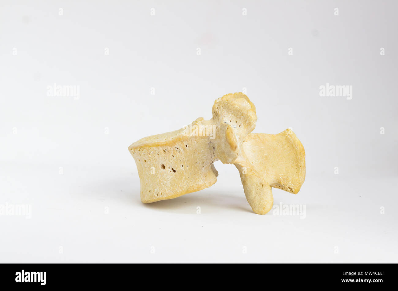 side view of isolated human lumbar vertebra in white background with ...