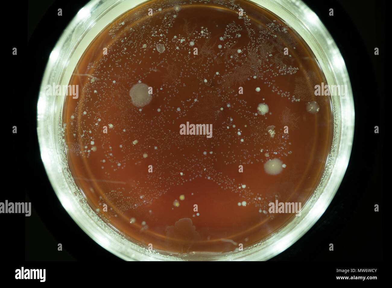 Growing Bacterial Colonies In Petri Dish Stock Photo - Alamy