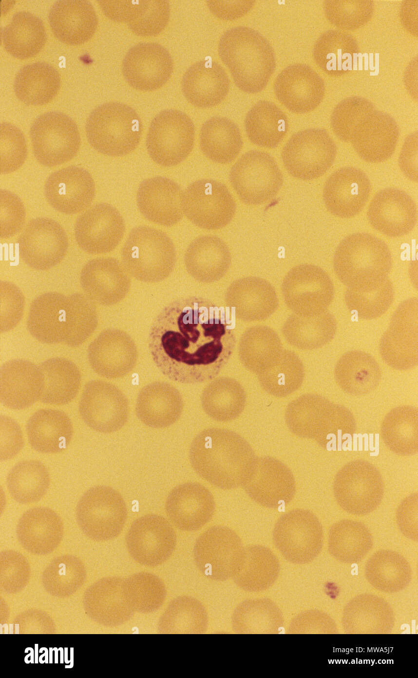 White blood cells microscope hi-res stock photography and images - Alamy