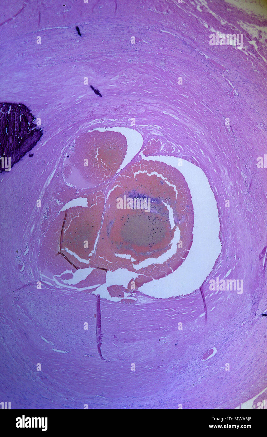 Aorta Microscope Image Labeled