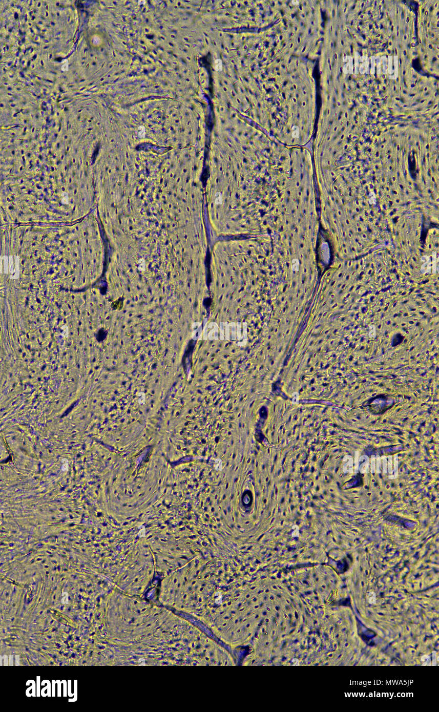 Human Bone Cells Under Microscope