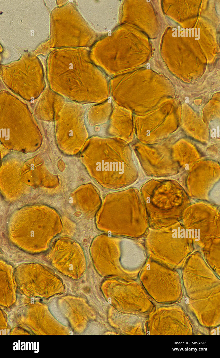 Adipose tissue hi-res stock photography and images - Alamy