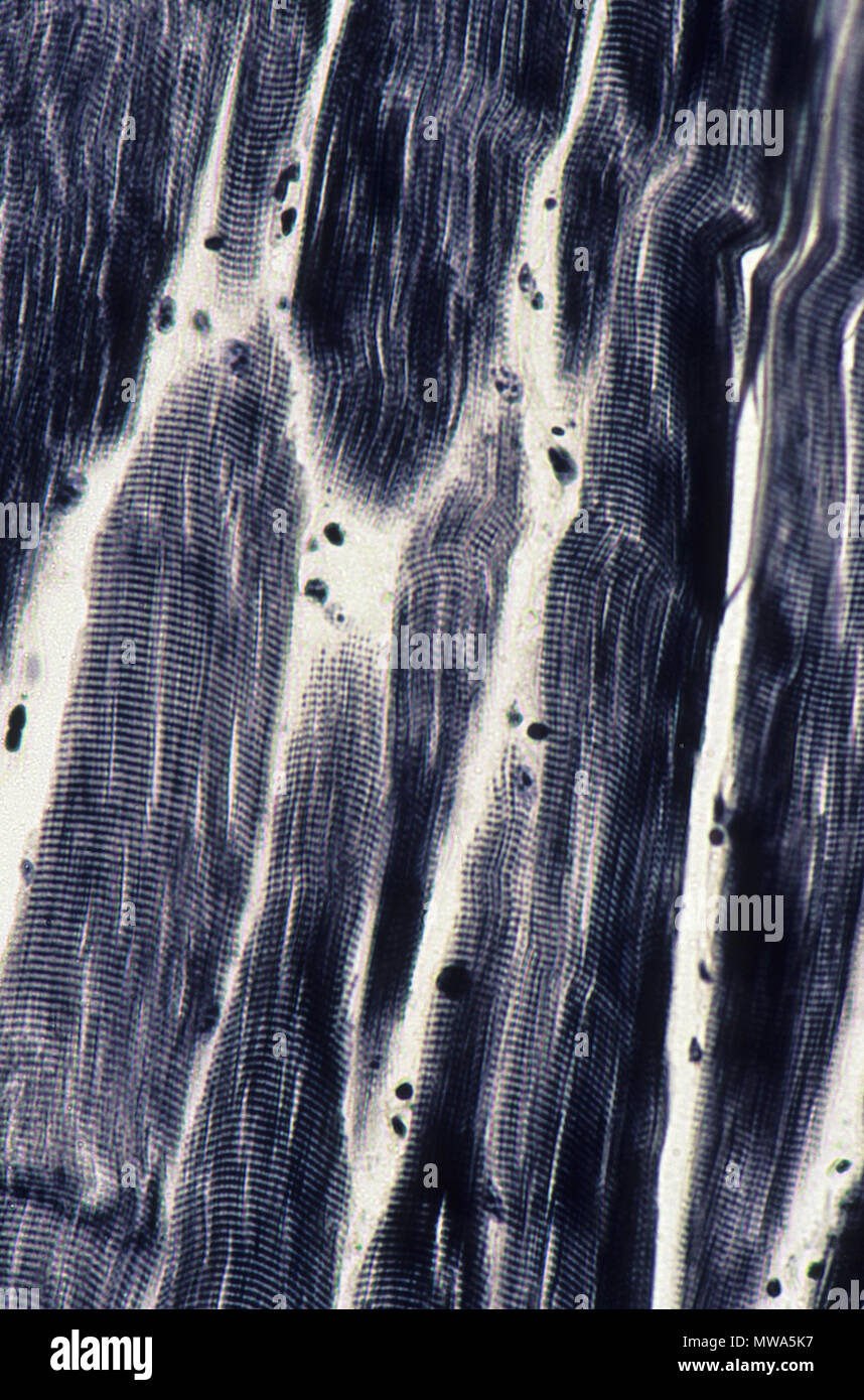 Human skeletal muscle microscope hi-res stock photography and images ...