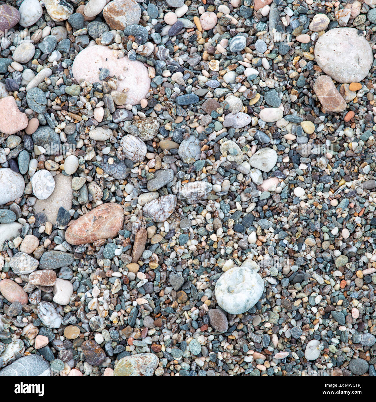 Bladder stones hi-res stock photography and images - Alamy