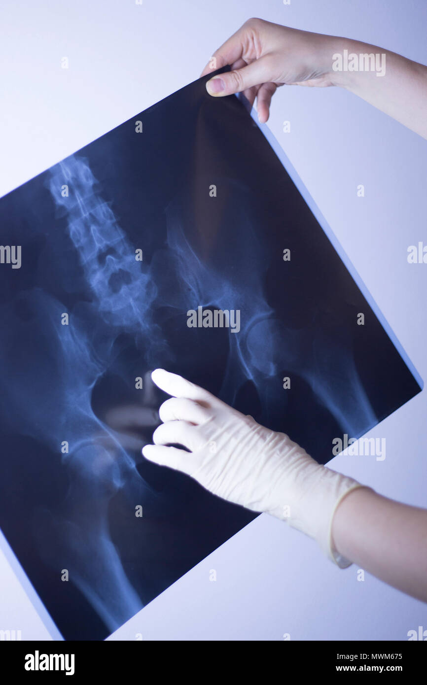 Medical hospital x-ray lowe back pain spine and hips traumatology scan ...