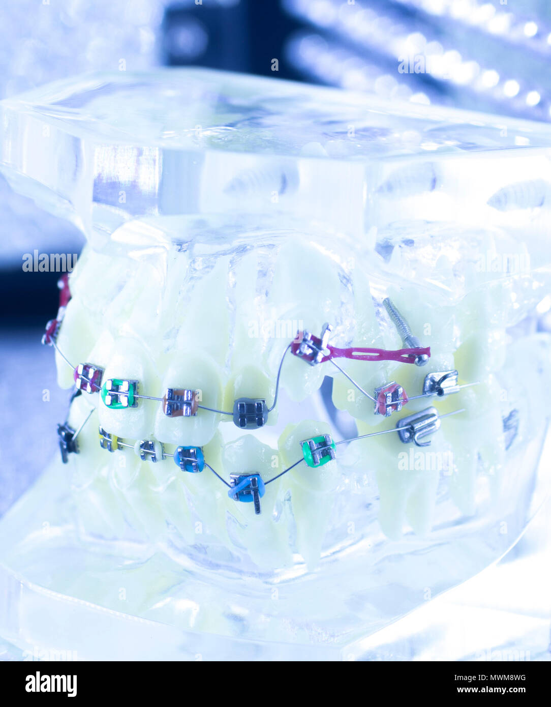 Orthodontics dentists teaching model dental teeth plastic and metal ...