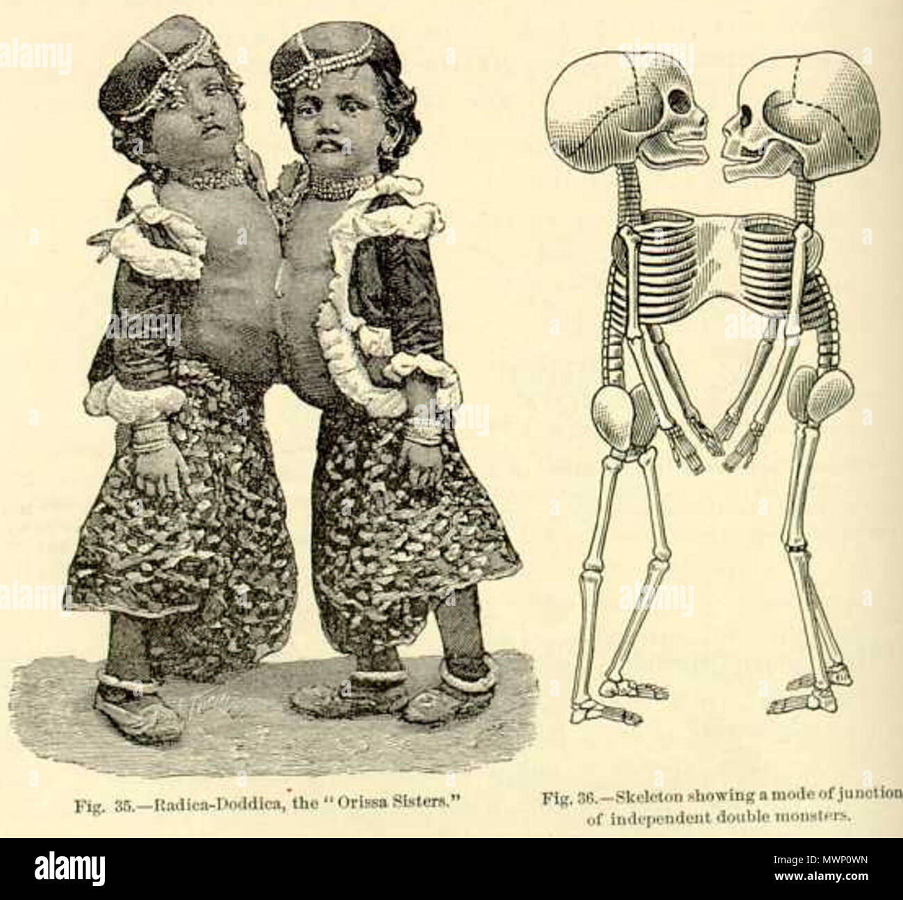 Radica and doodica twins hi-res stock photography and images - Alamy
