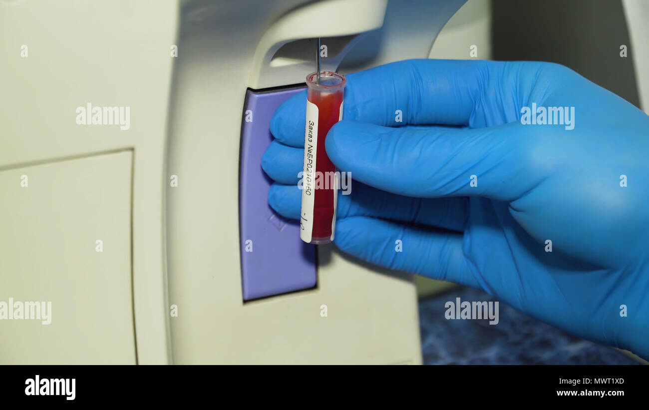 Blood Smear High Resolution Stock Photography and Images - Alamy