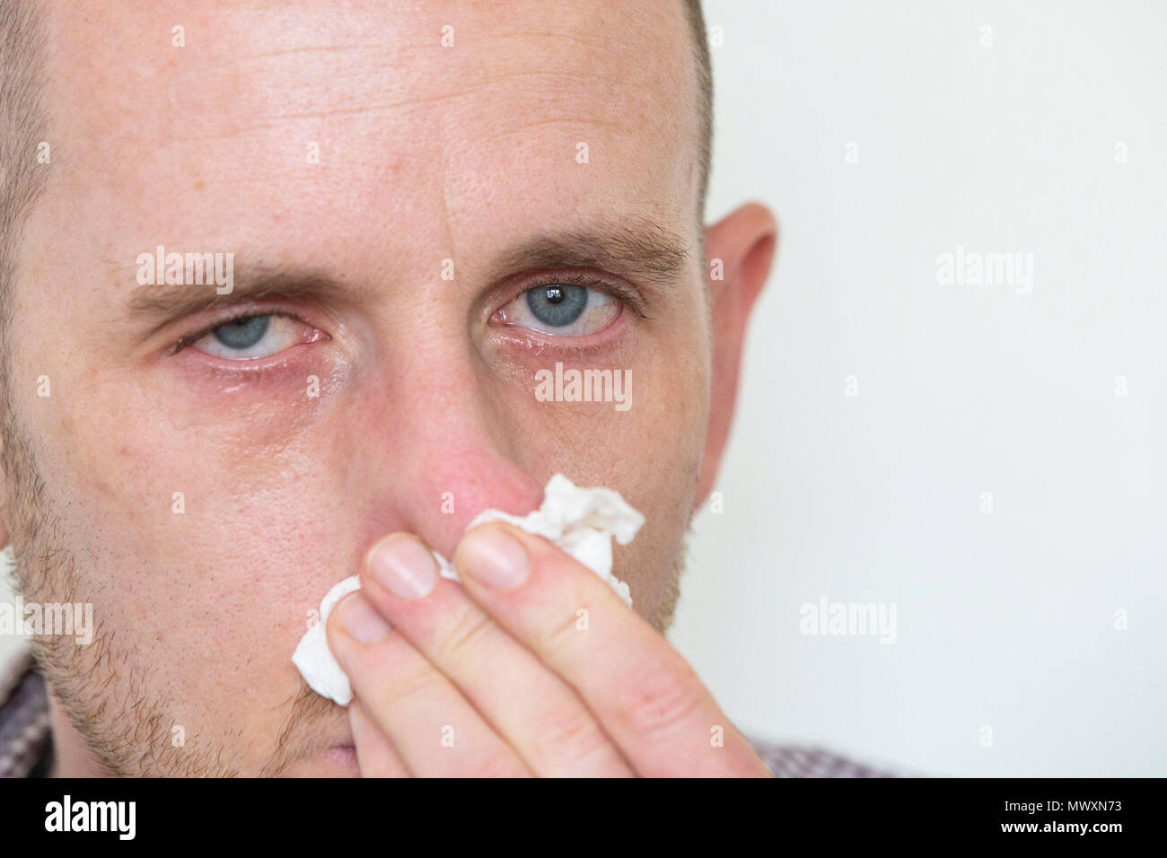 Cetirizine hi-res stock photography and images - Alamy