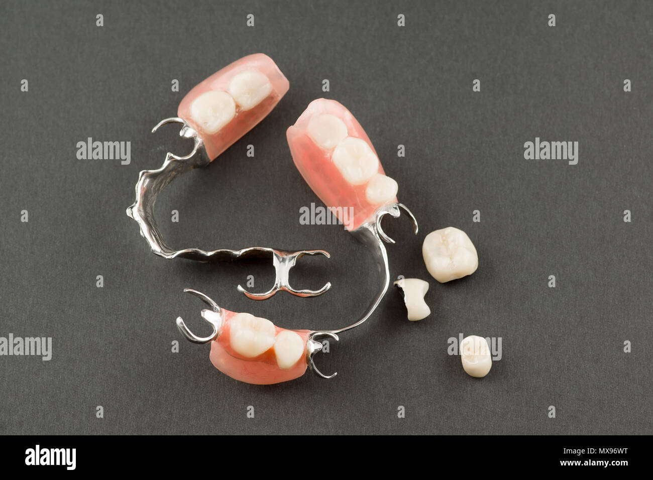 large image of a modern denture on a black background Stock Photo - Alamy