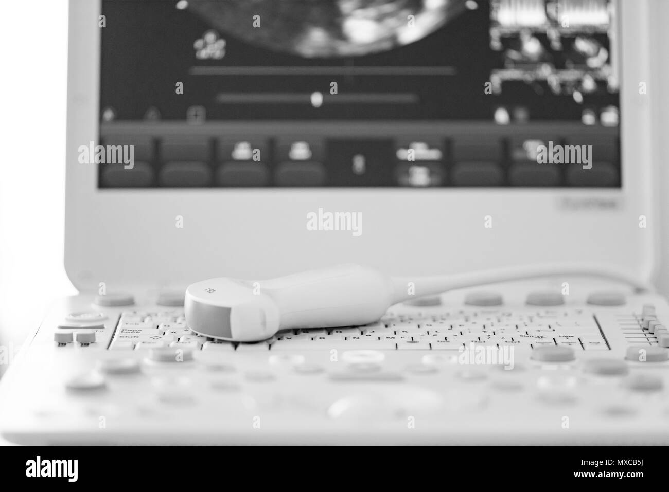 Modern ultrasound machine with sensors Stock Photo - Alamy