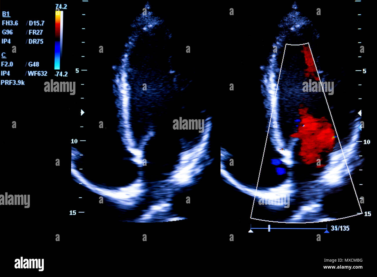 Colourful image of modern ultrasound monitor. Ultrasonography machine ...