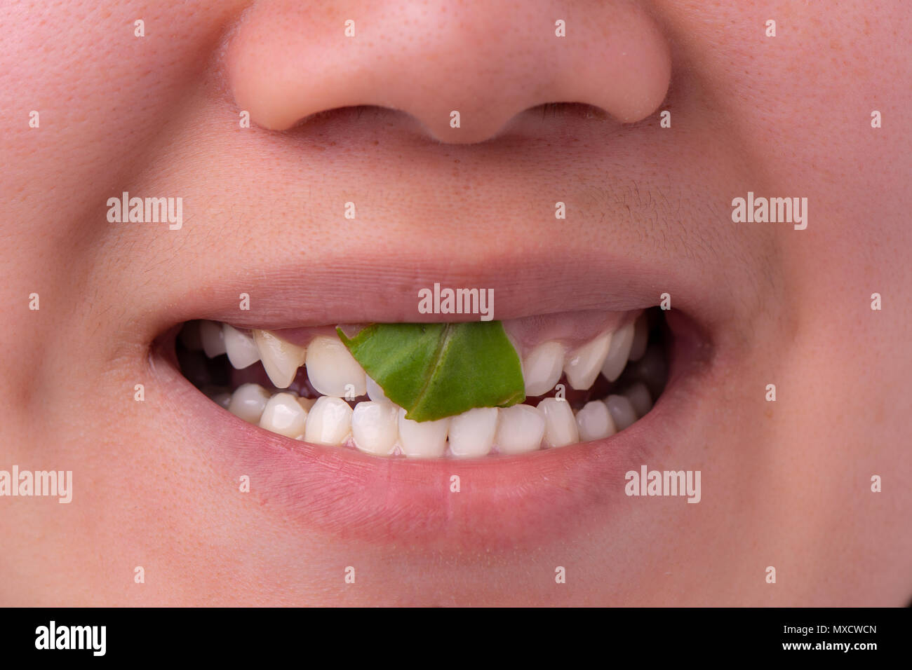 Food stuck in tooth hi-res stock photography and images - Alamy