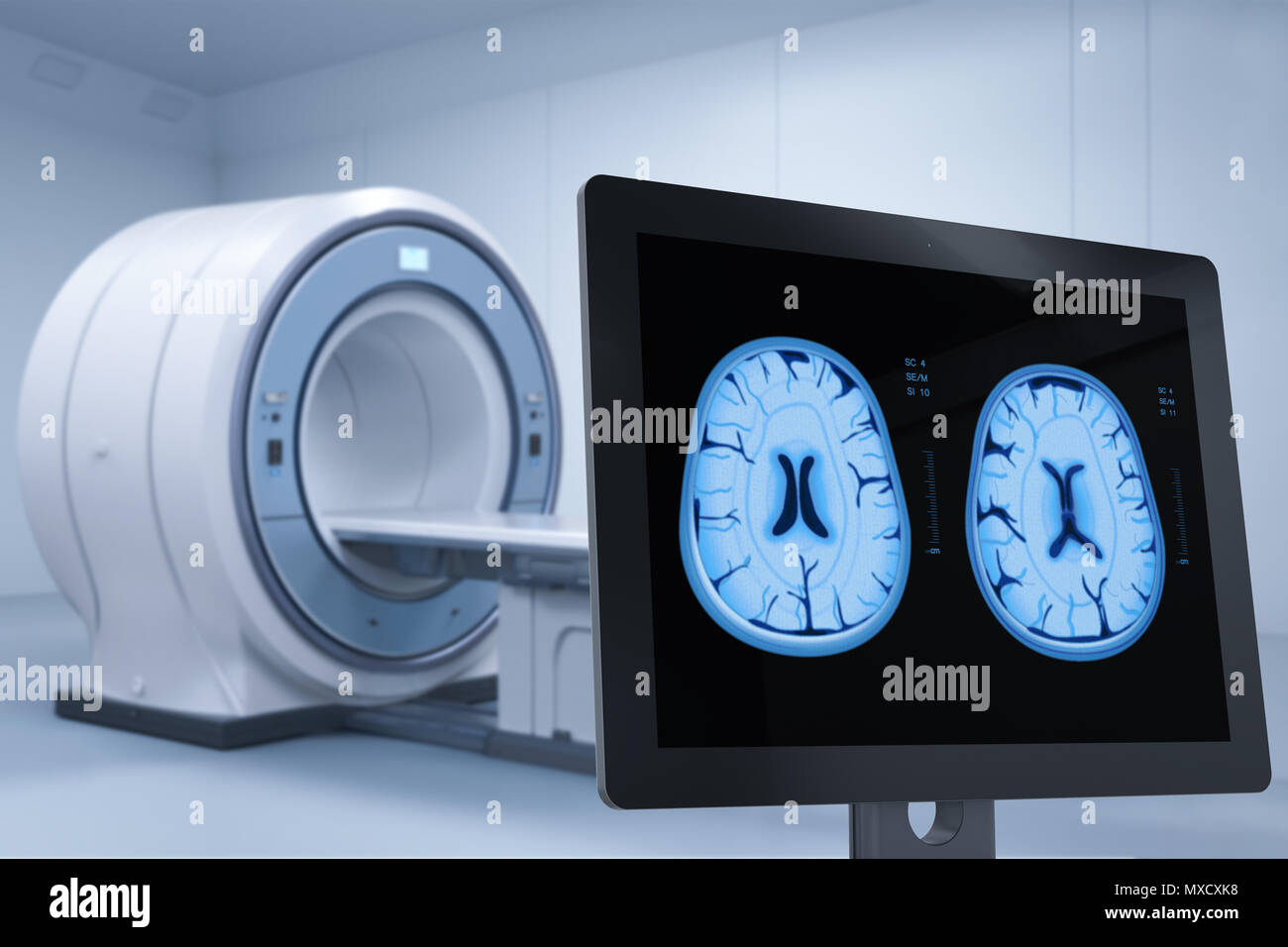 3d rendering computer monitor display x-ray brain in mri lab Stock Photo - Alamy