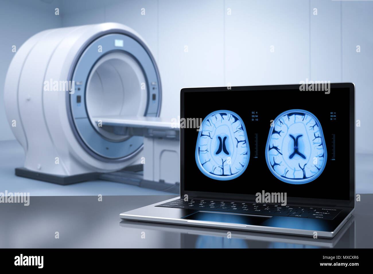 Mri brain scan computer screen hi-res stock photography and images - Alamy