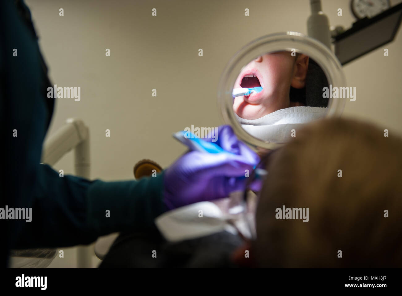 Channing Wray, holds a mirror to watch as his dentist cleans his teeth ...