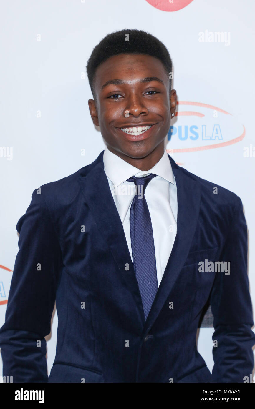 Lupus LA Orange Ball 2018 was held at the Beverly Wilshire Hotel in ...