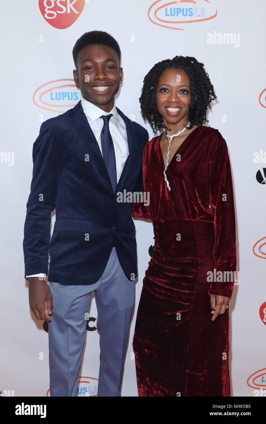 Lupus LA Orange Ball 2018 was held at the Beverly Wilshire Hotel in ...