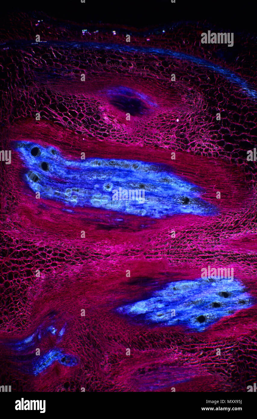 Xylem vessel hi-res stock photography and images - Alamy