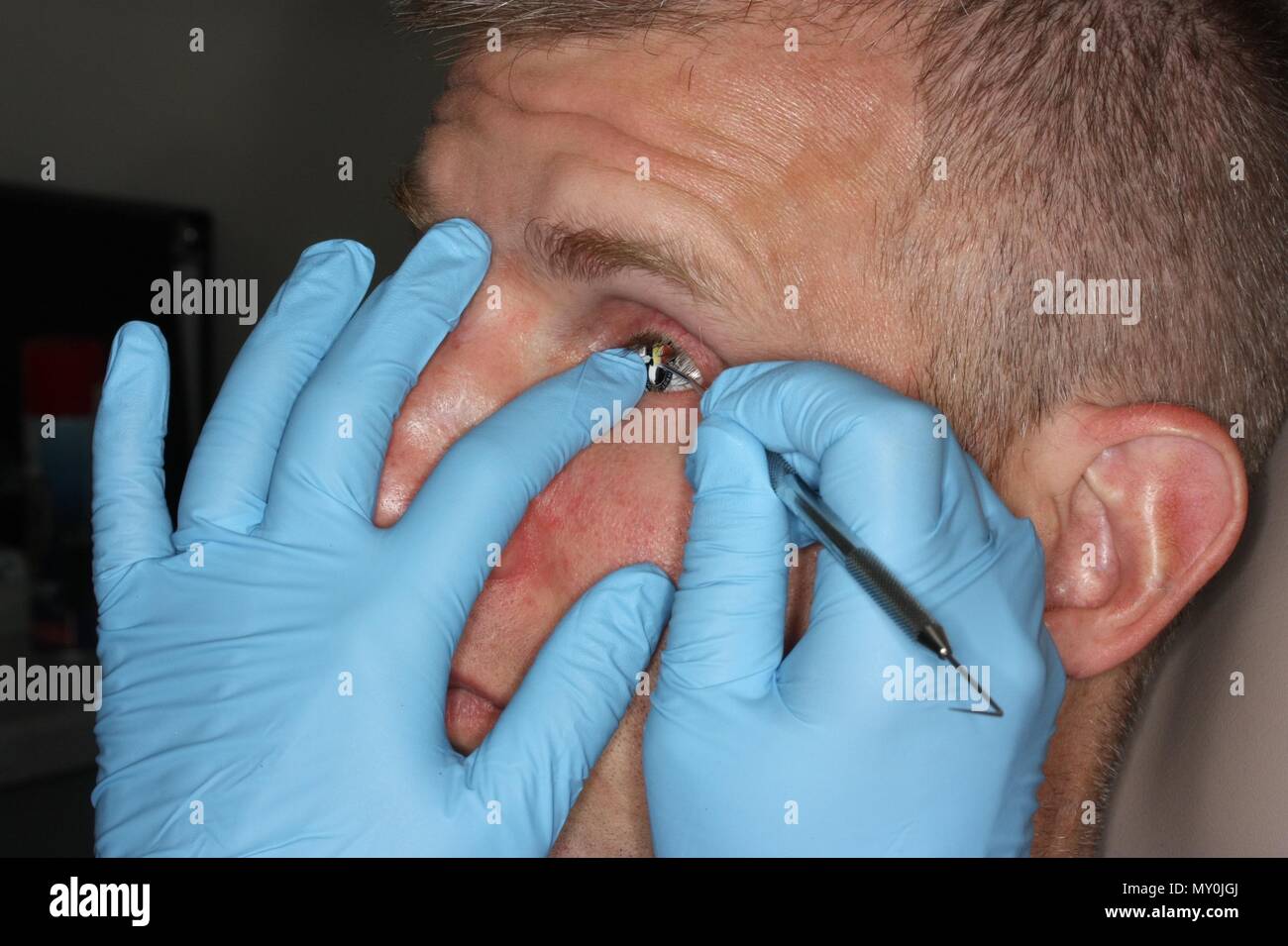 Lt. Col. Kenneth Dwyer, patient and Special Forces officer assigned to ...