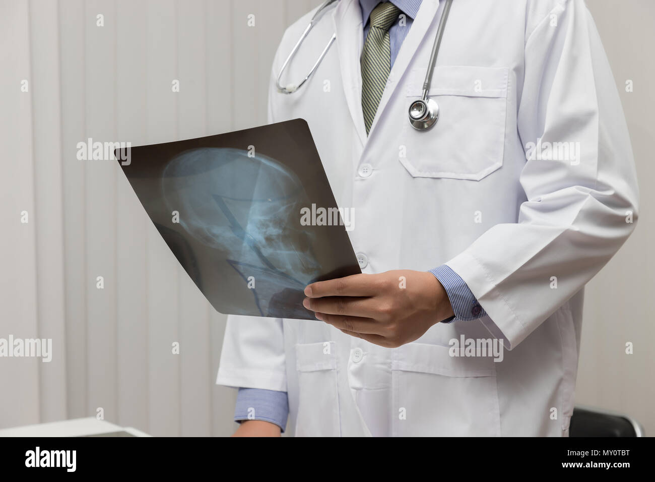 X ray equipment medical examination healthcare and medicine technology ...