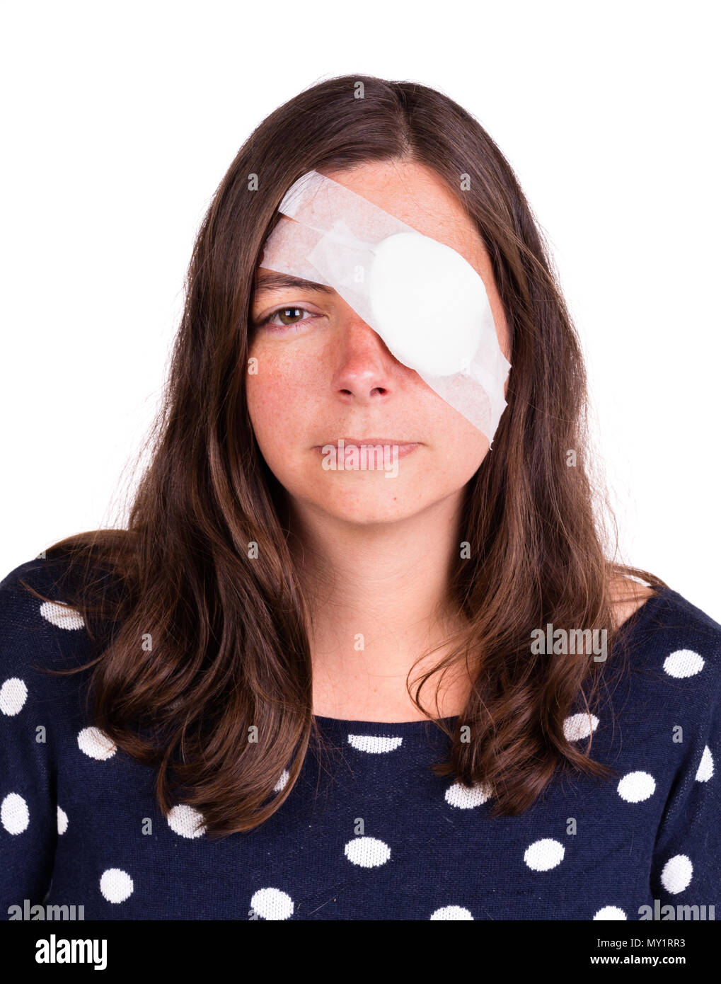 White eye patch hi-res stock photography and images - Alamy