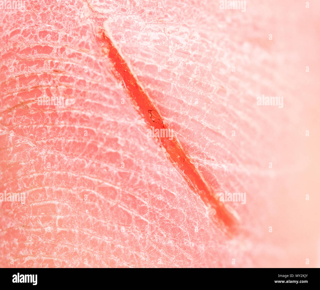Scratch skin hi-res stock photography and images - Alamy