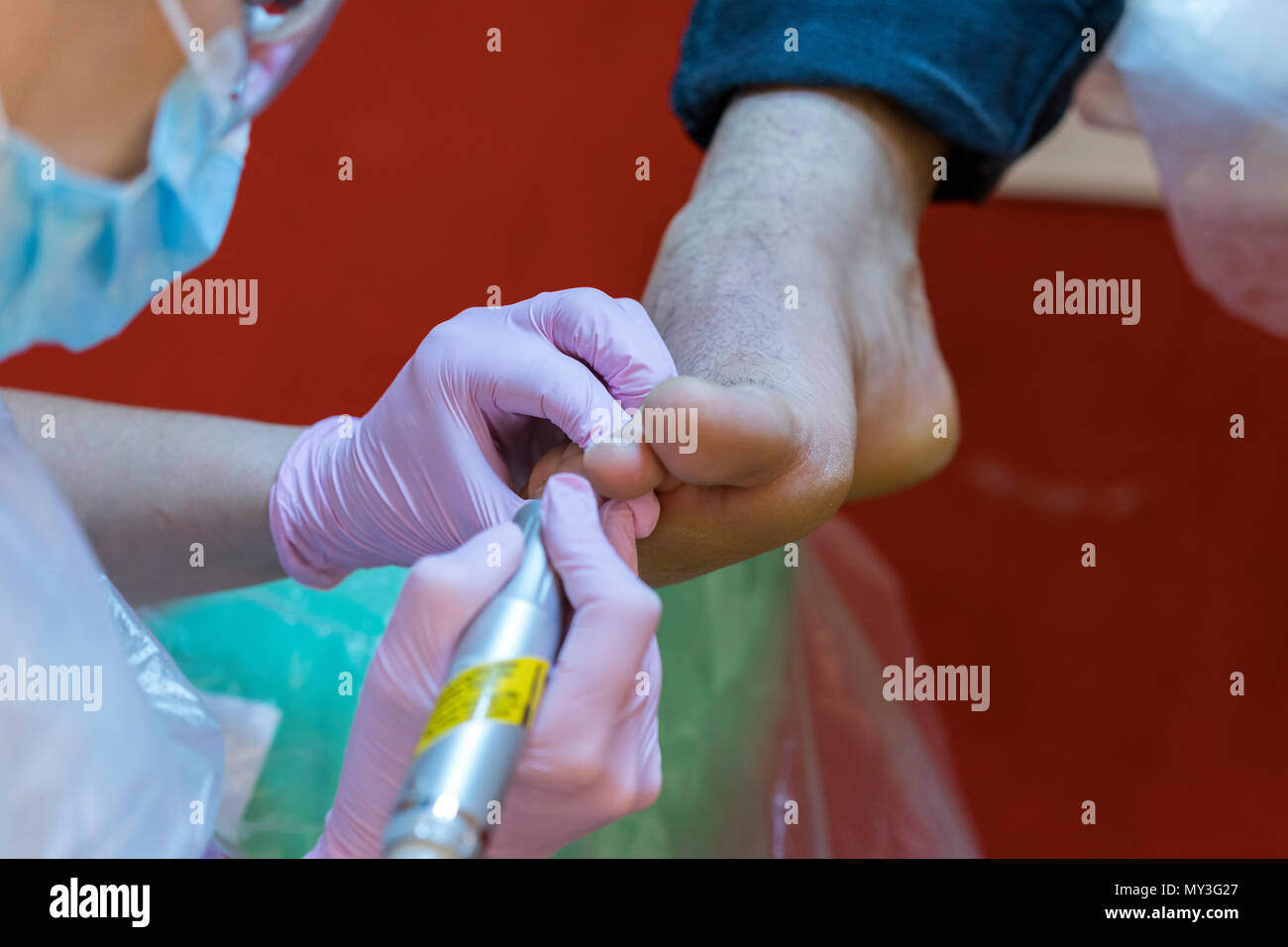 Podiatry doctor. Treatment of feet and nails Stock Photo - Alamy