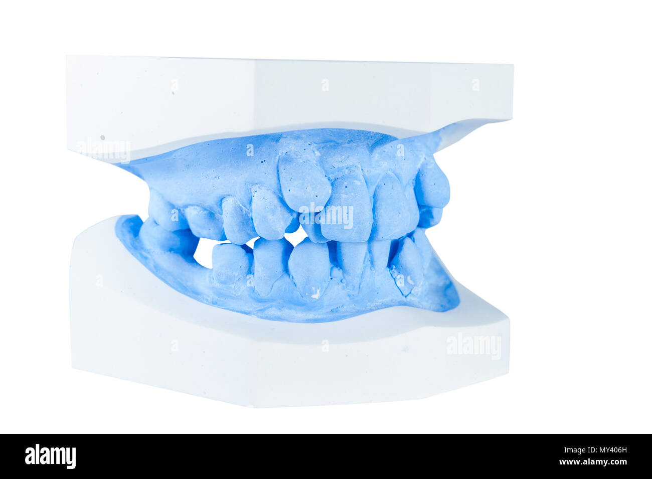 teeth moldel on isolated white background Stock Photo - Alamy