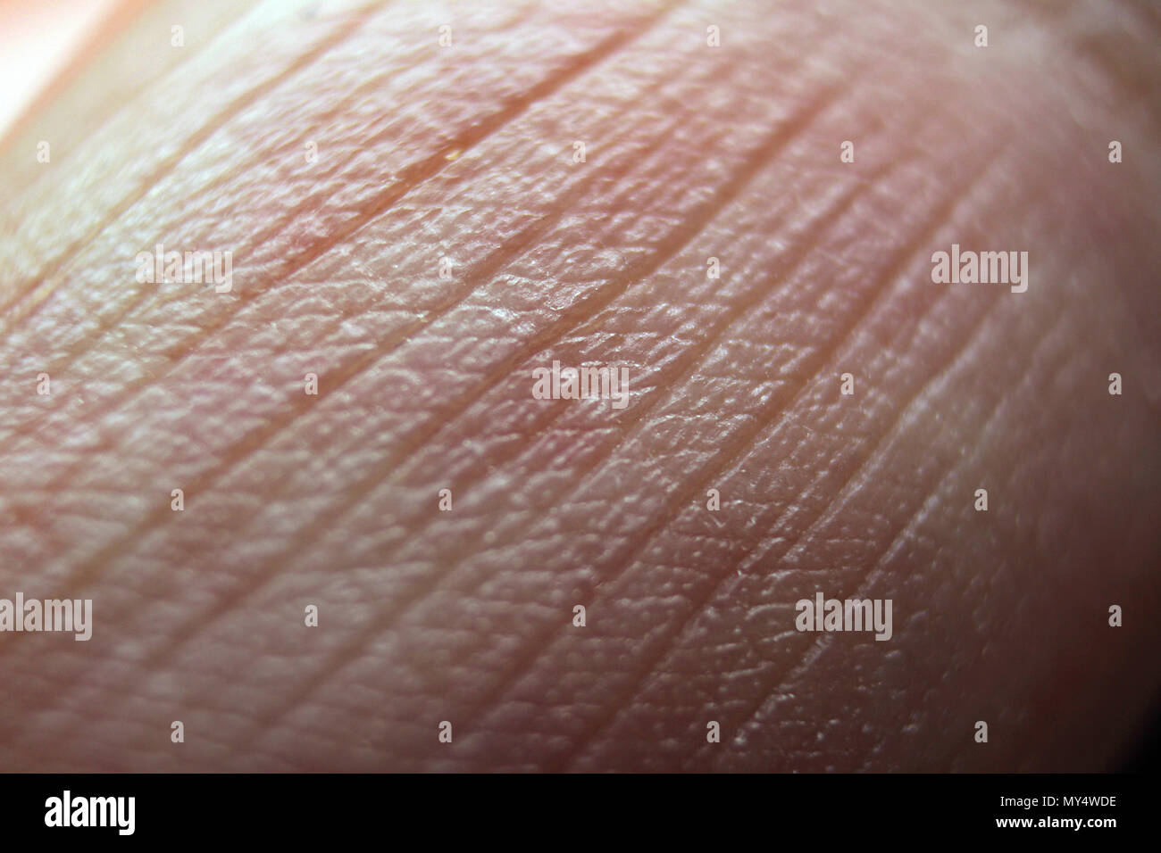 Epithelial tissue hi-res stock photography and images - Alamy