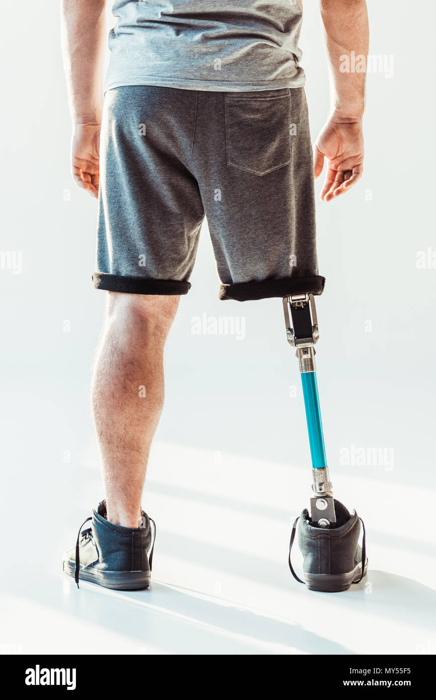 Amputation body part legs hi-res stock photography and images - Alamy