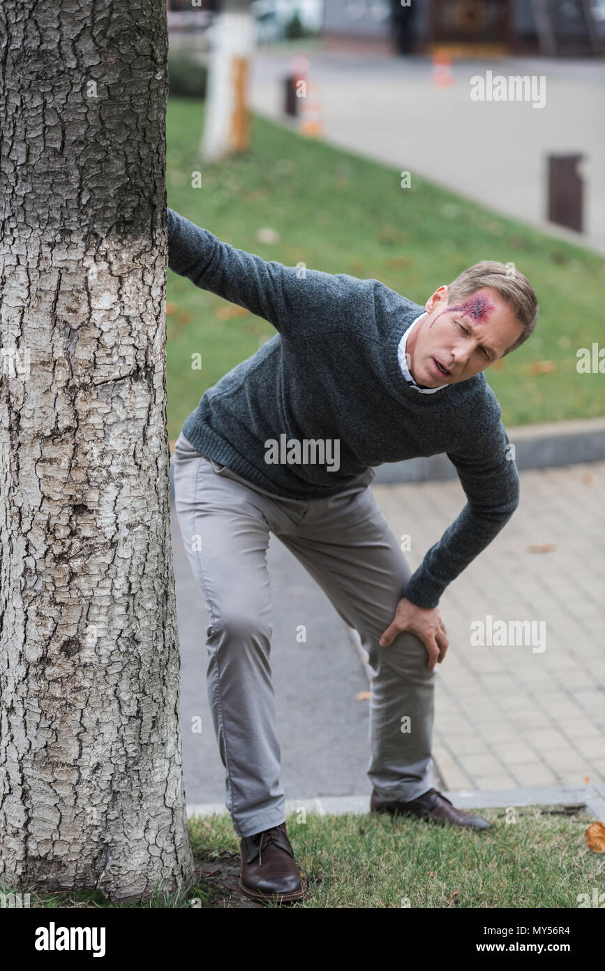 Man head injury street hi-res stock photography and images - Alamy