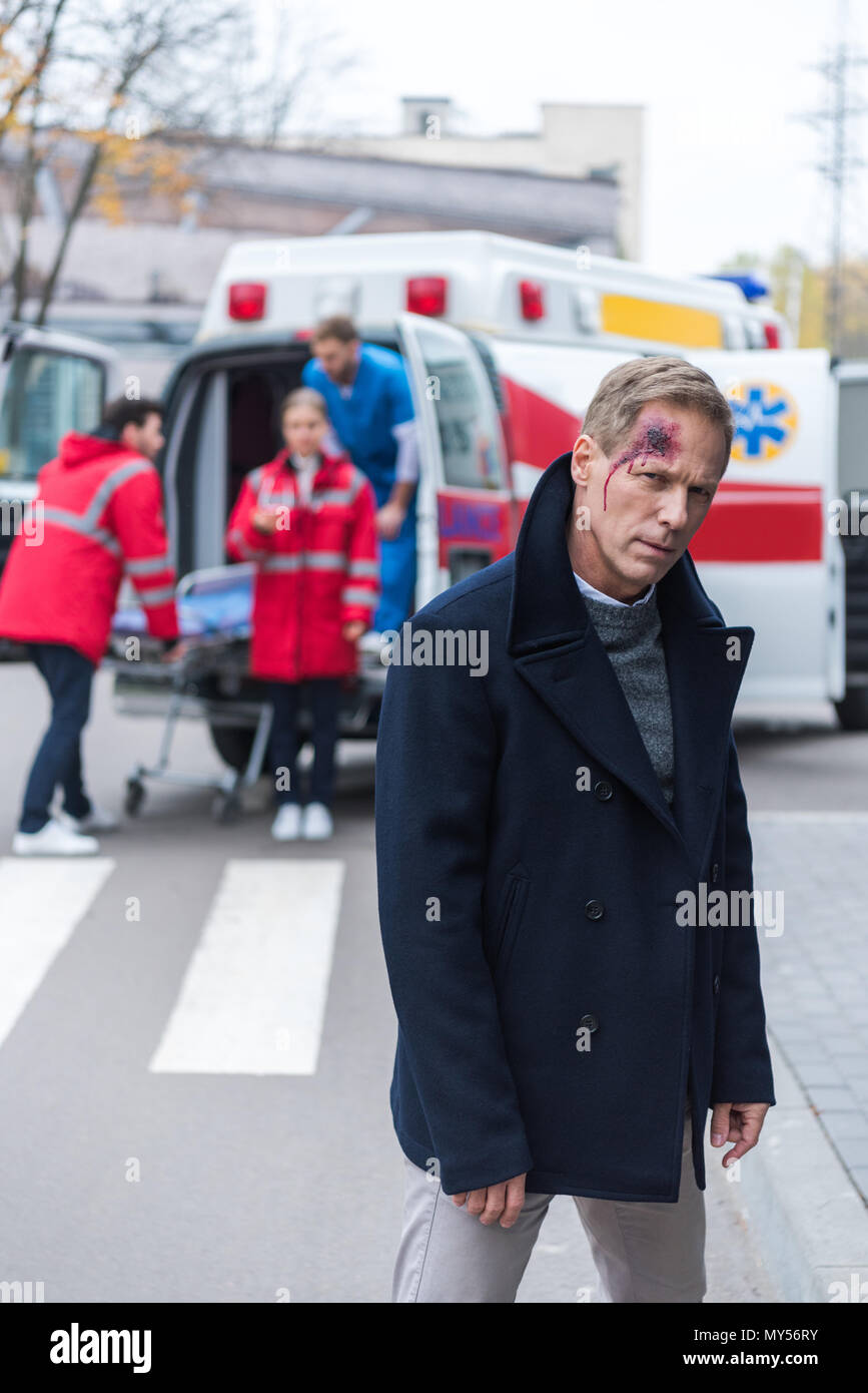 injured man with wound on head standing and looking at camera Stock ...