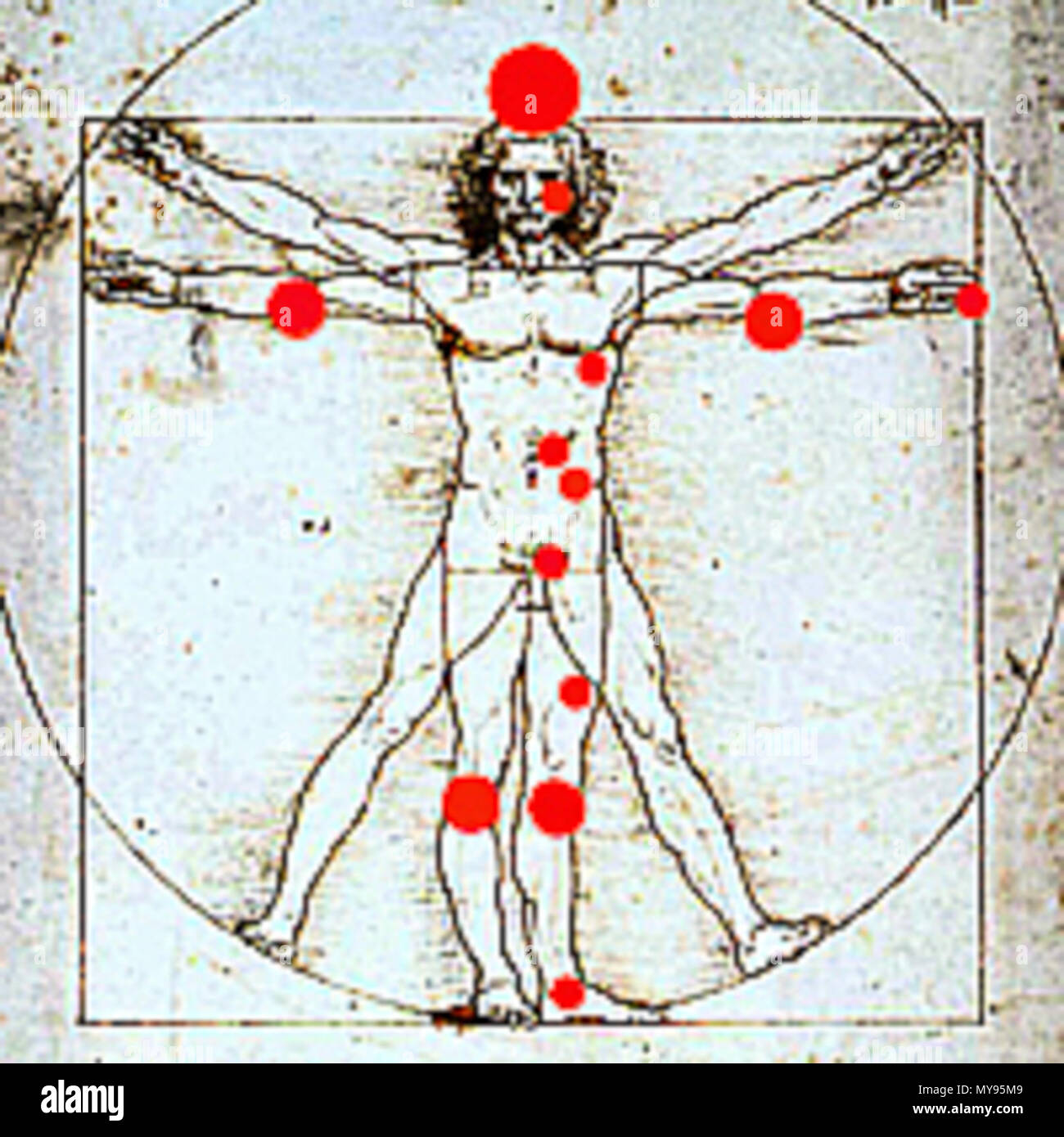 Red scaly patches hi-res stock photography and images - Alamy