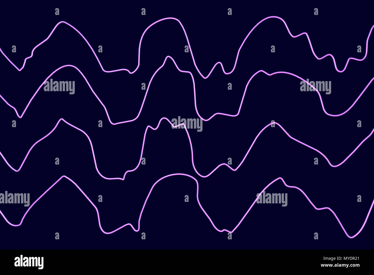 Eeg Brain Wave Test Digital
