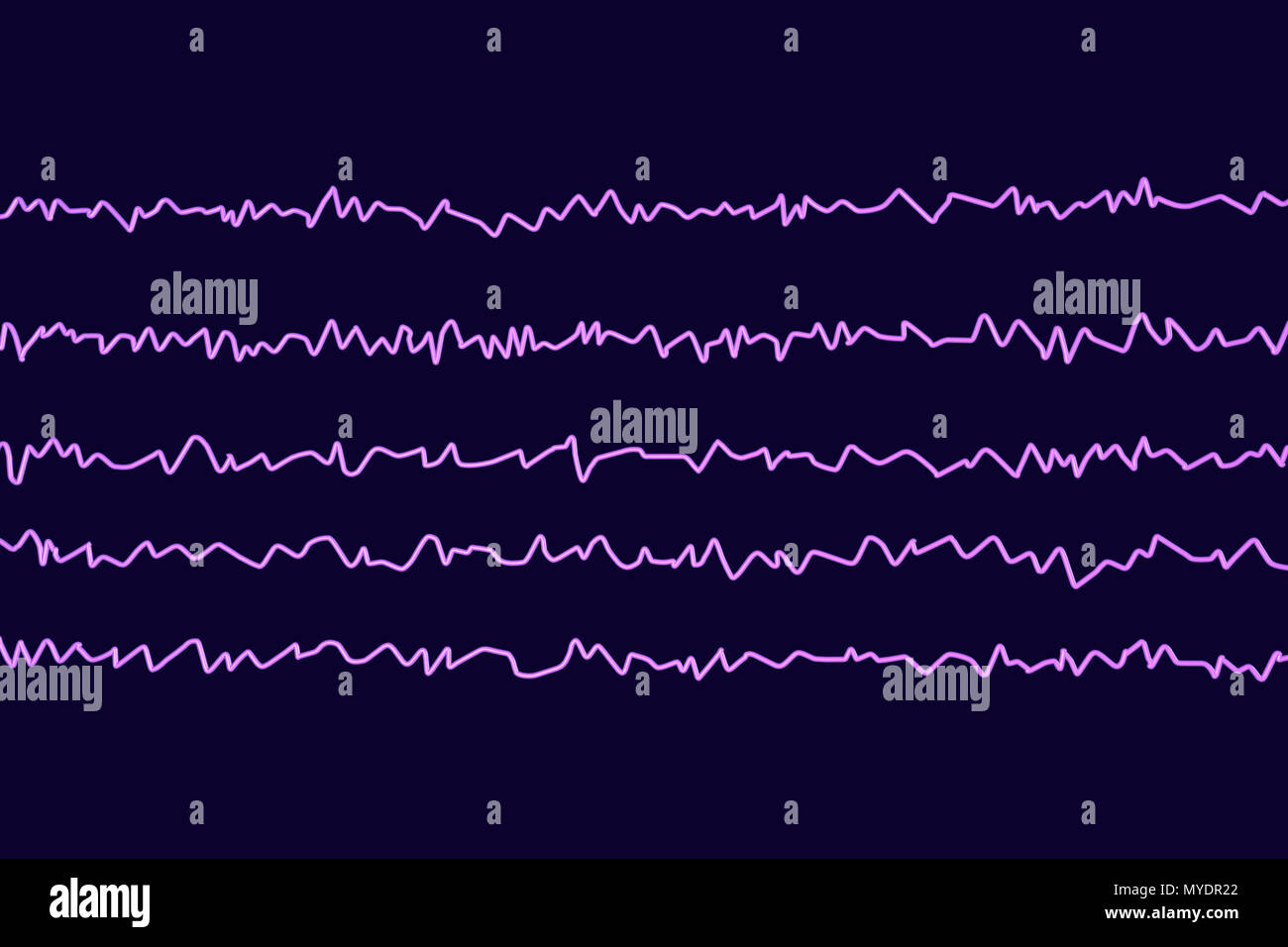 Brain waves in awake state with mental activity, computer illustration ...