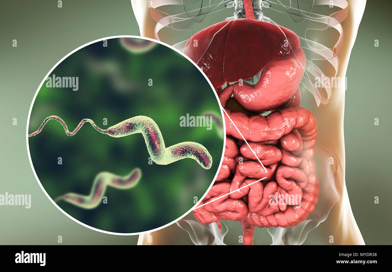 Campylobacteriosis, conceptual illustration. Campylobacter jejuni is a ...