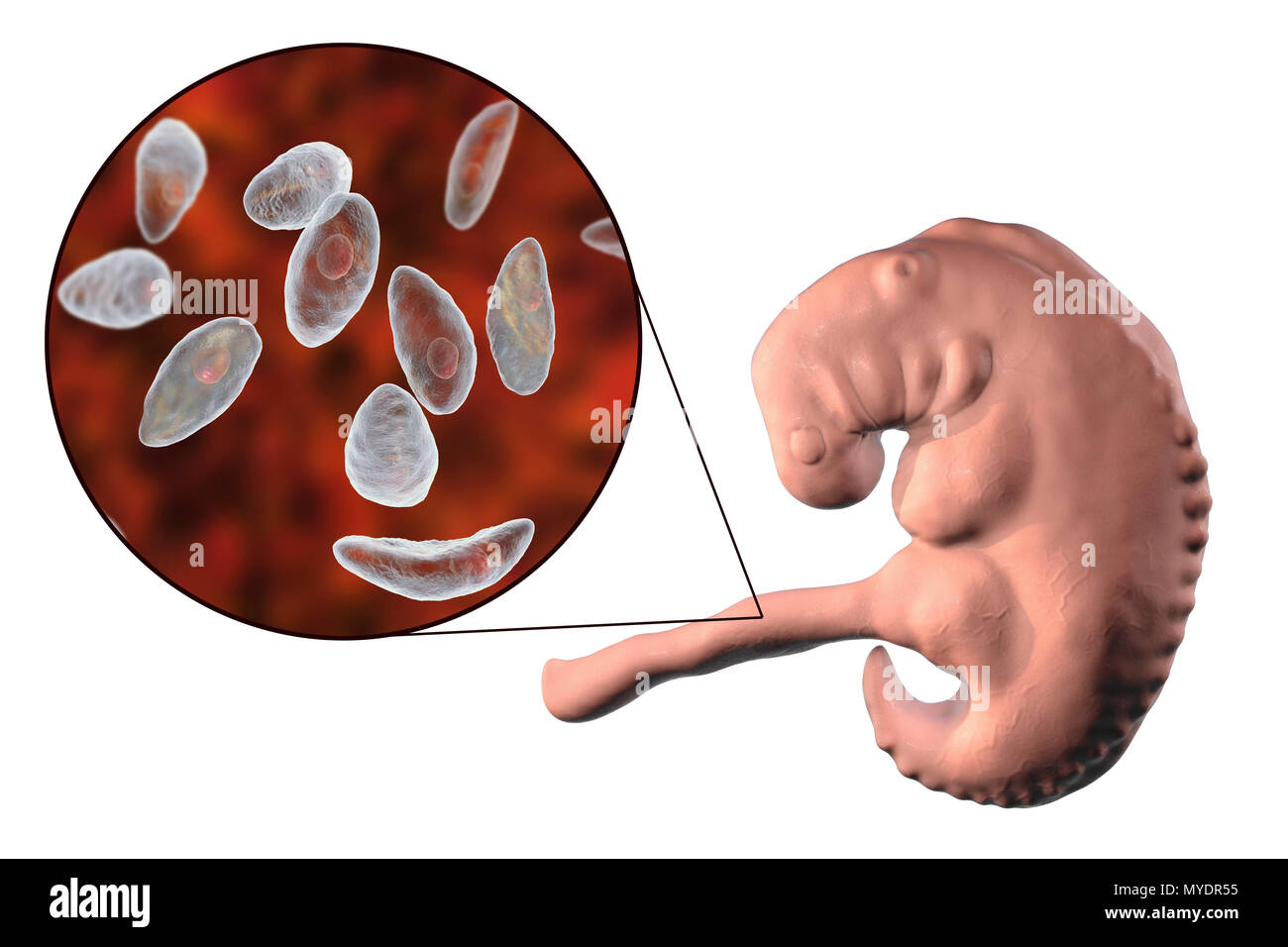 Transplacental transmission of Toxoplasma gondii parasites to human ...