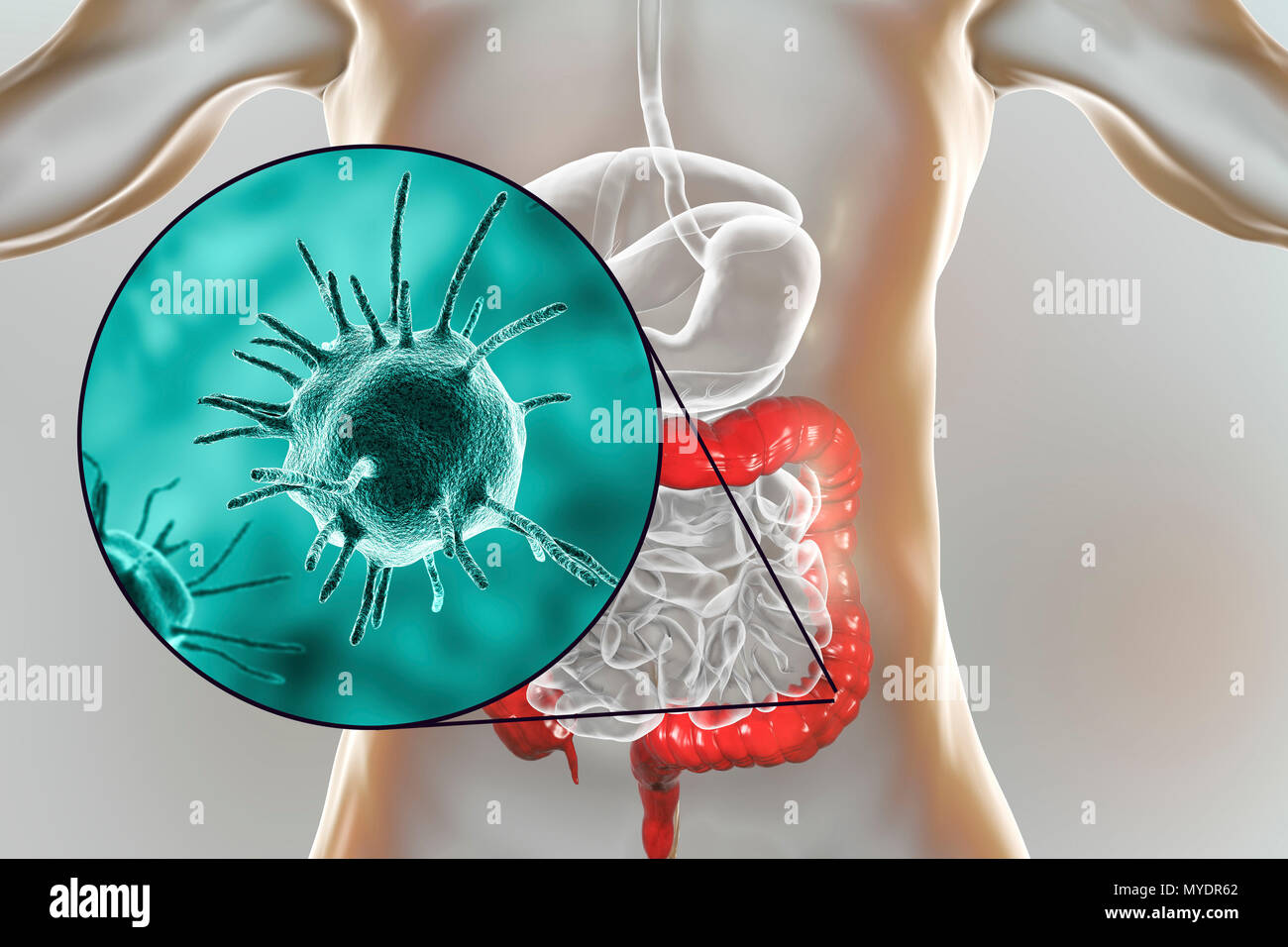 Computer illustration of abstract pathogenic microorganisms in human ...