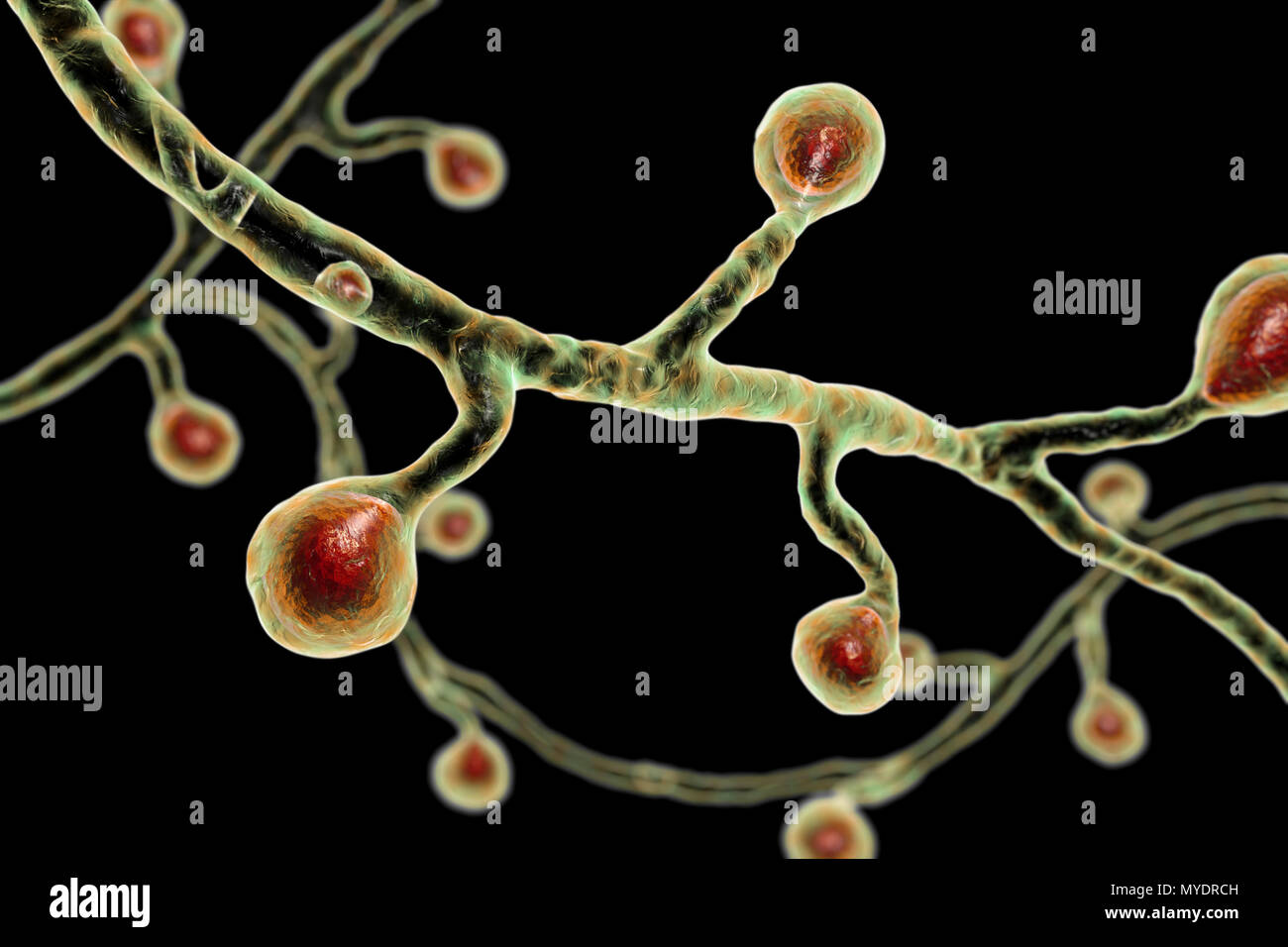 Blastomycosis Skin Lesions