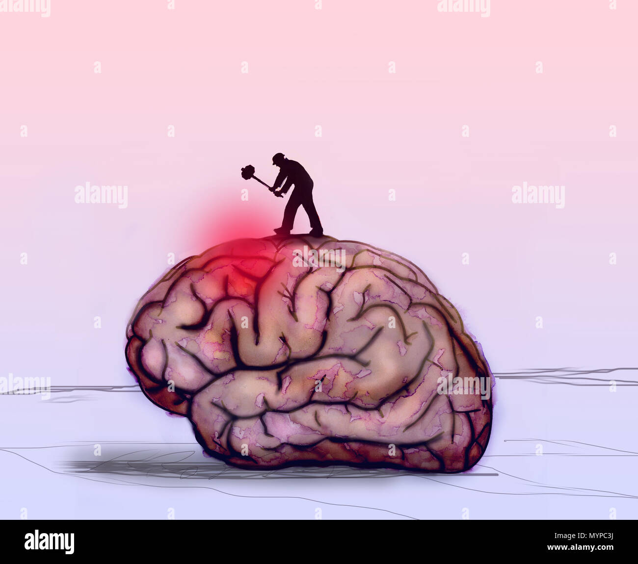 Hammer Hitting Brain