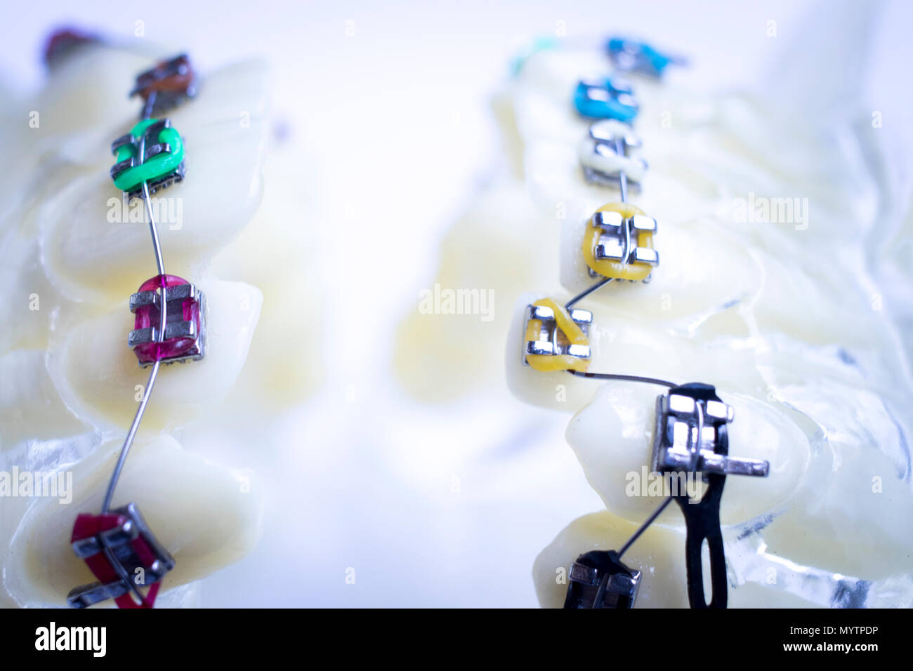 Dental metal braces teeth retainer aligners teaching orthodontics model ...