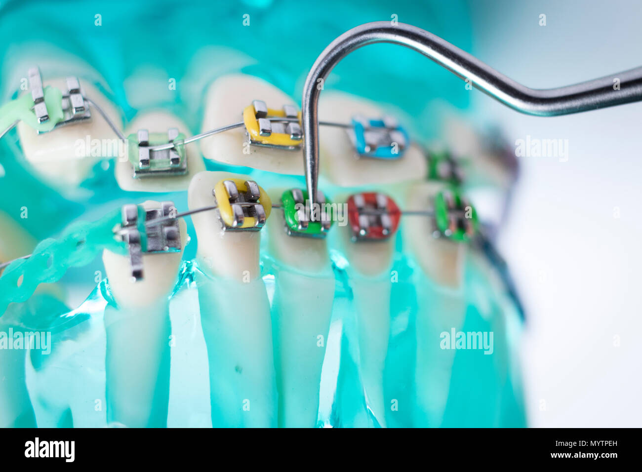 Dental metal braces teeth retainer aligners teaching orthodontics model ...