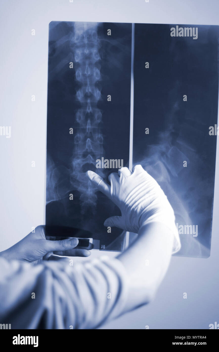 Medical hospital x-ray lowe back pain spine and hips traumatology scan ...