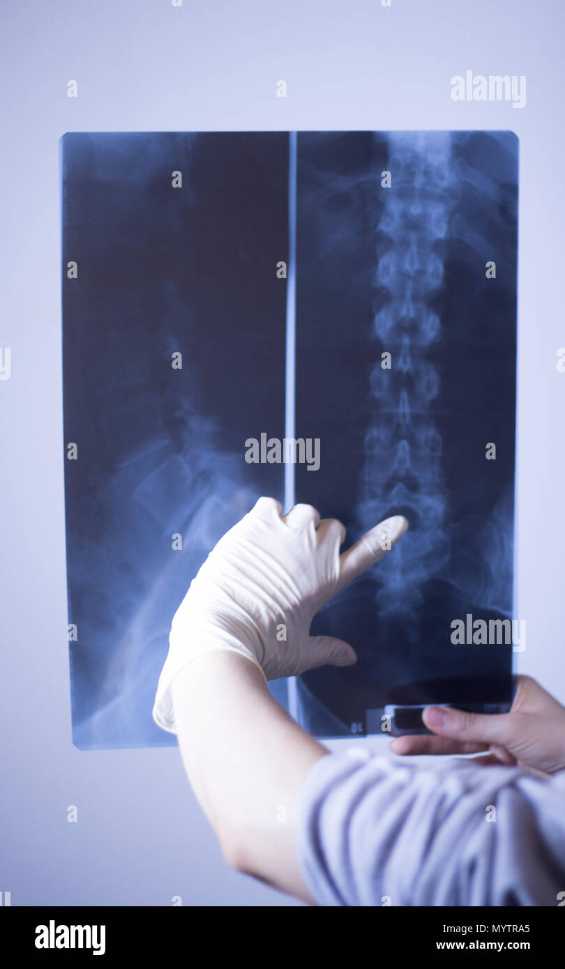 Medical hospital x-ray lowe back pain spine and hips traumatology scan ...