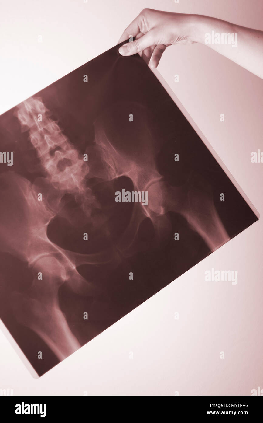 Medical hospital x-ray lowe back pain spine and hips traumatology scan ...